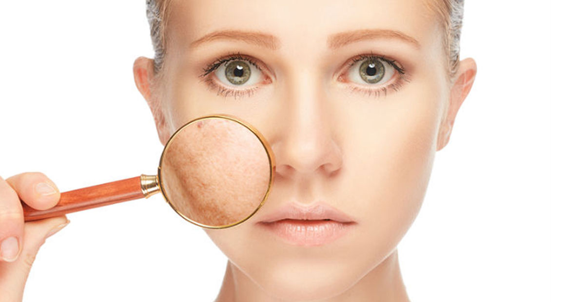 Skin Pigmentation Treatment in Hyderabad at Skin Clinic